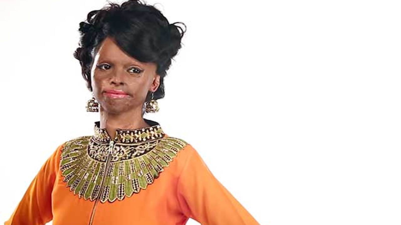 Une jeune femme brûlée à l'acide devient égérie d'une marque indienne ...