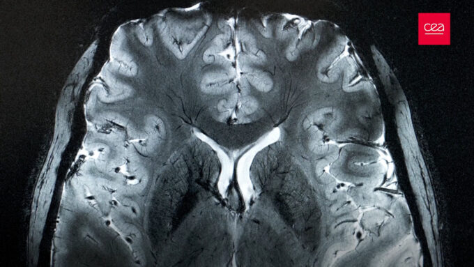 L'IRM le plus puissant du monde a pris une image jamais vue du cerveau ...
